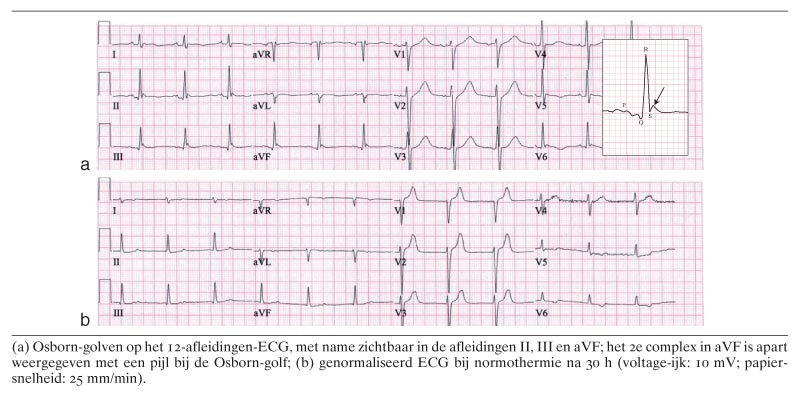 Diagnose in beeld (209). Een te water geraakte man | Nederlands ...