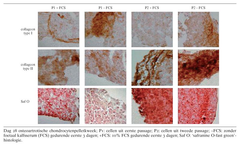 Nederlandse Orthopaedische Vereniging | Nederlands Tijdschrift voor ...