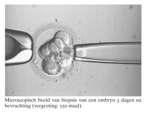 Preïmplantatiegenetische screening op numerieke chromosoomafwijkingen ...