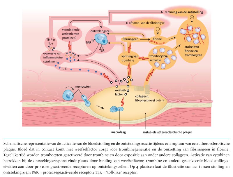 Acute luchtweginfecties en acute coronaire syndromen | NTVG