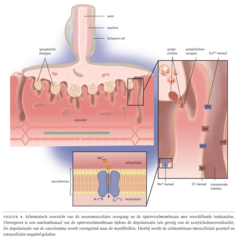 Het spectrum van de erfelijke skeletspierkanalopathieën | NTVG