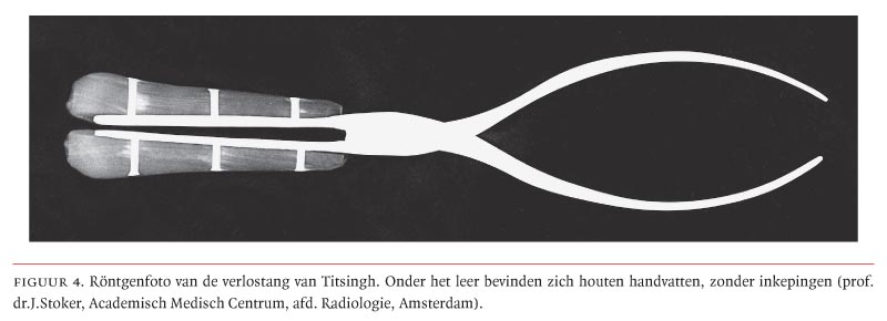 Raadsels rond een verlostang van Albertus Titsingh (1714-1790 ...
