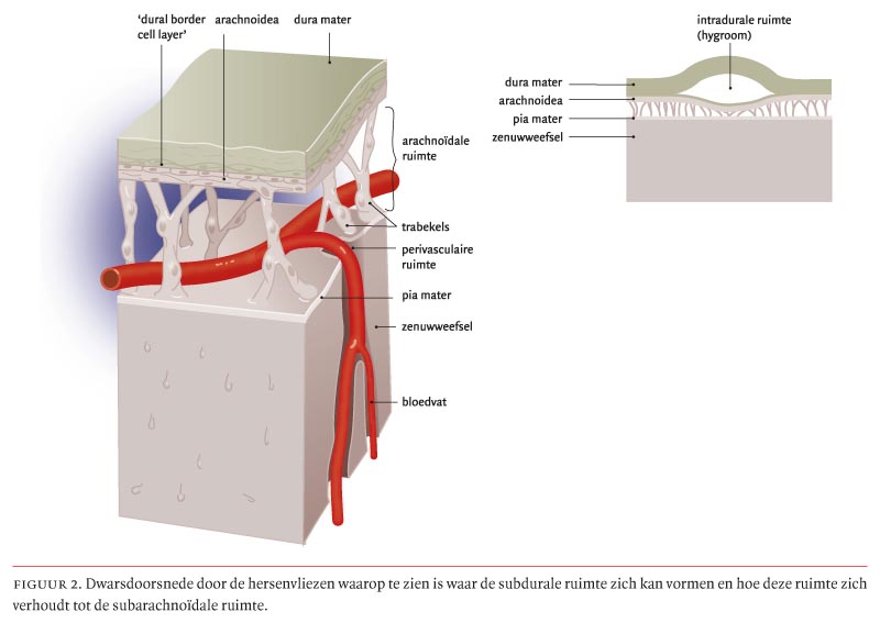 Een subduraal hygroom na een val van de trap | Nederlands Tijdschrift ...