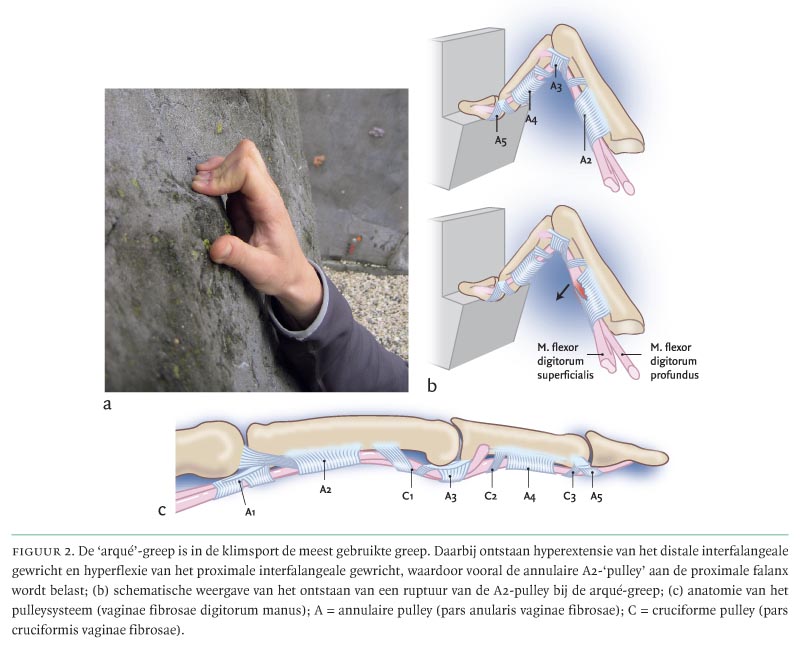 Blessures aan de arm bij sportklimmers | Nederlands Tijdschrift voor ...