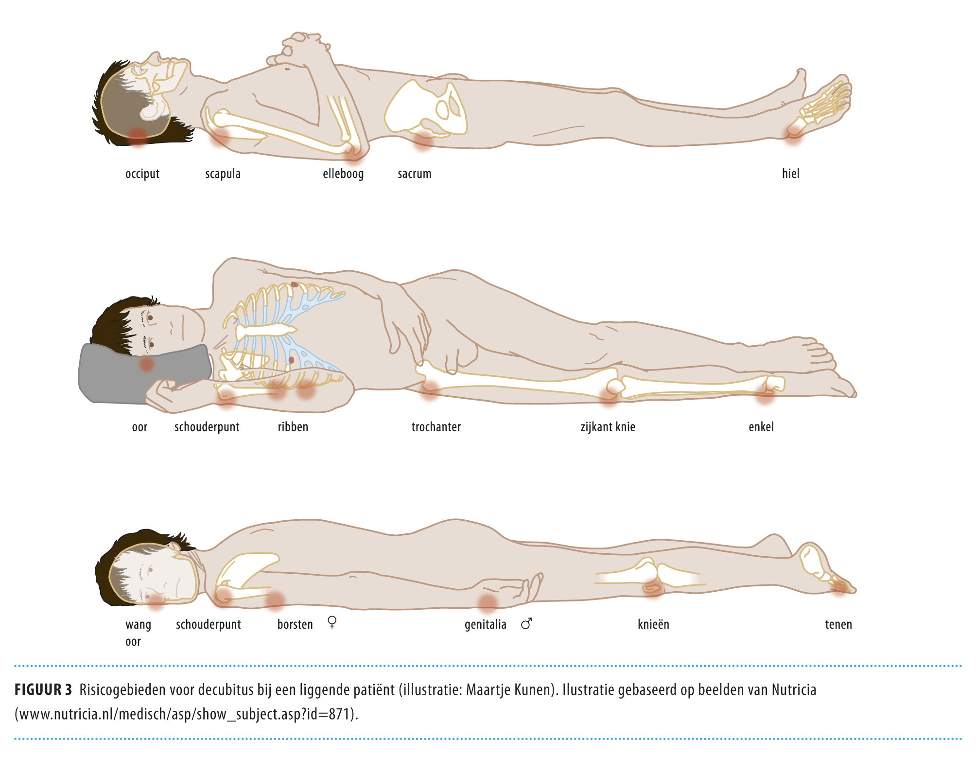decubitus - DrBeckmann