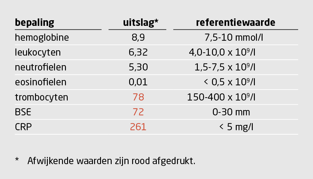 Terugkerende koorts na een reis in de tropen | NTvG