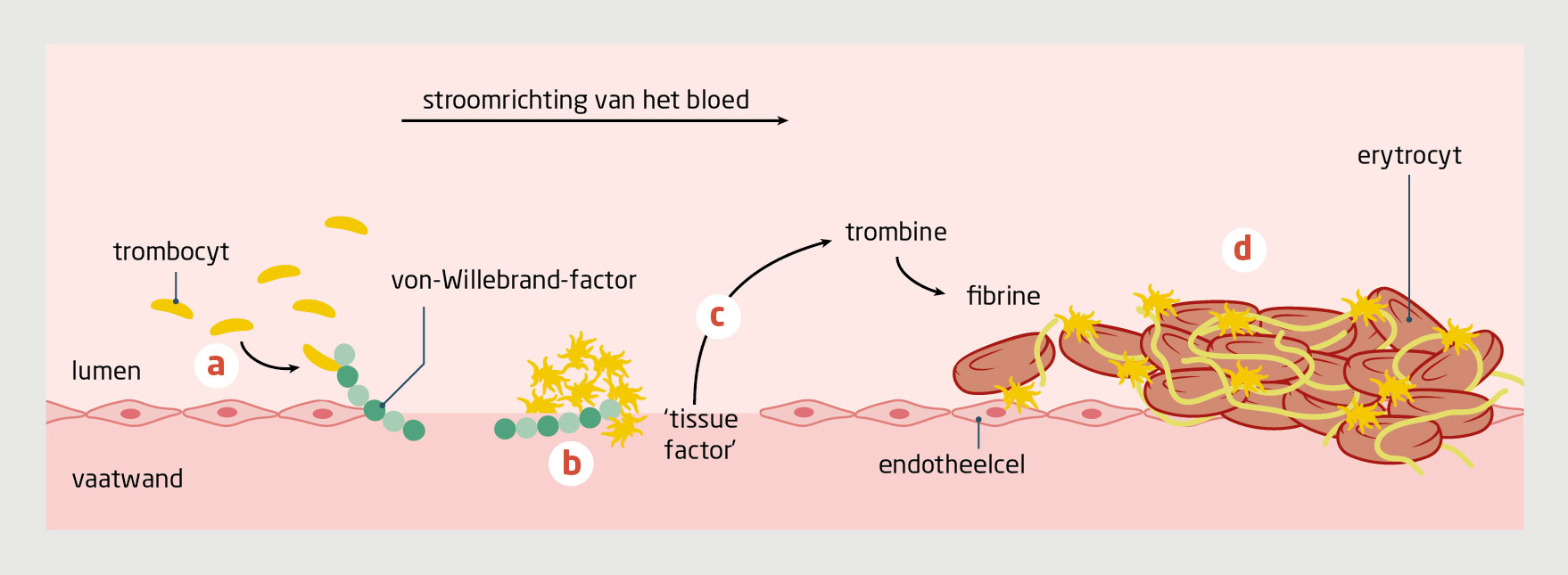 Diagnostiek bij een vermoedelijke stollingsstoornis | NTVG