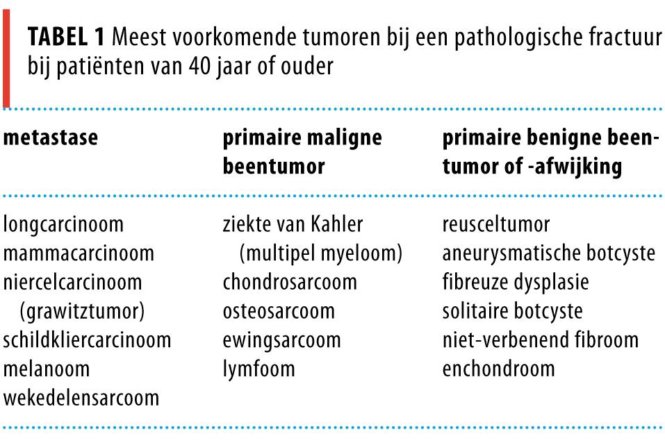 Diagnostiek en behandeling van botmetastasen | NTVG