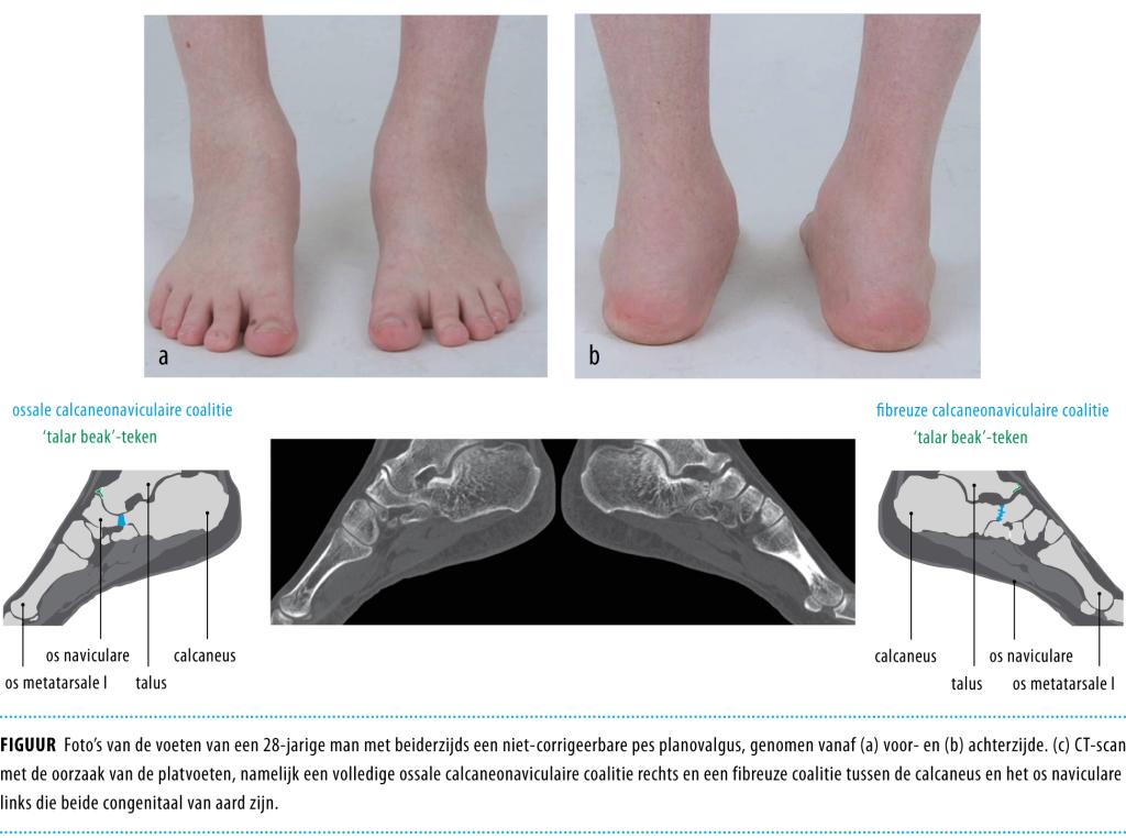 Een jongeman met pijnlijke voeten | NTvG