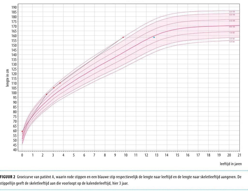 Premature pubarche is niet altijd onschuldig | NTVG