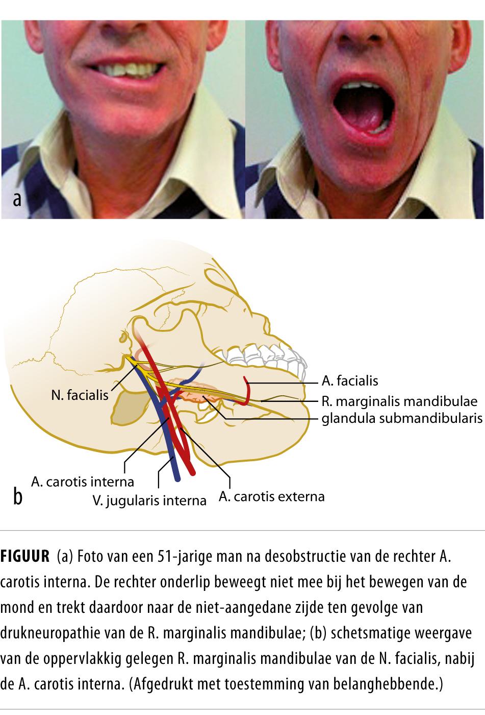 Een man met een scheve lach | NTvG