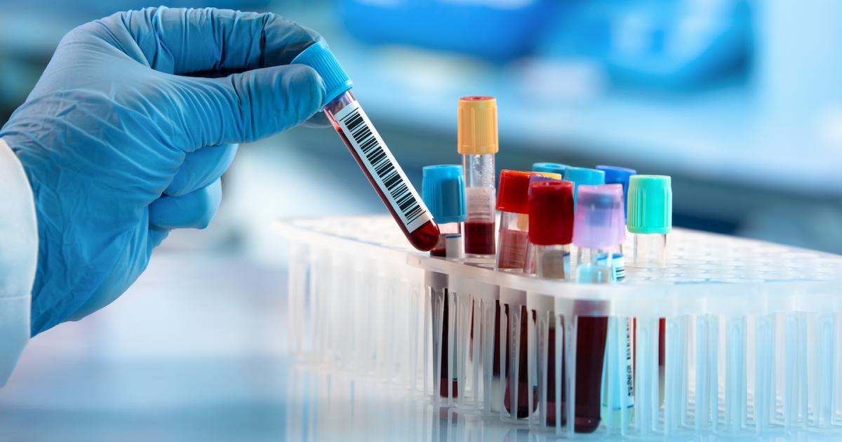 Slechter cognitief presteren bij ouderen met kleine cerebrale ...