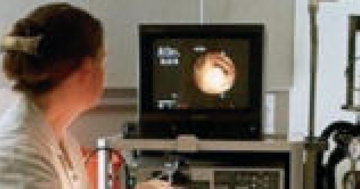 Poliepen weghalen verlaagt sterfte door dikkedarmkanker | NTVG