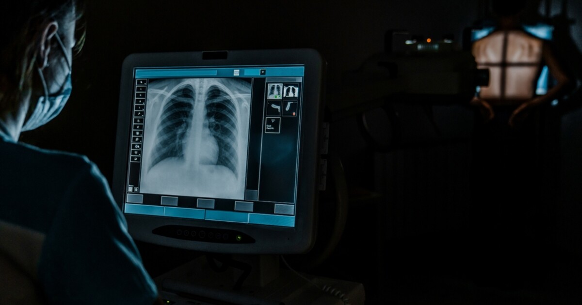 ‘Ultra-low-dose’ CT versus X-thorax op de SEH | NTVG